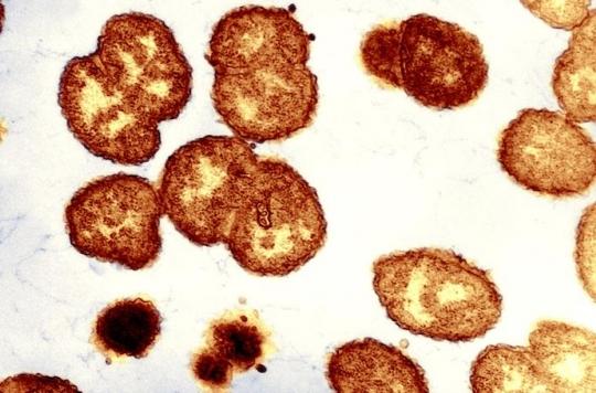 Gonorrhée : les bactéries résistent aux antibiotiques